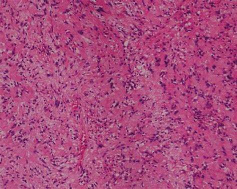 Low Power Photomicrograph Case 2 Hande 10x Download Scientific