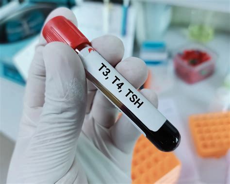 Get To Know Your Thyroid Test