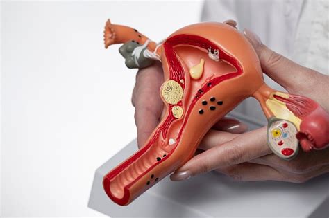 What Is Laparoscopic Tubectomy Surgery By Mahesh Neelam Aug 2023