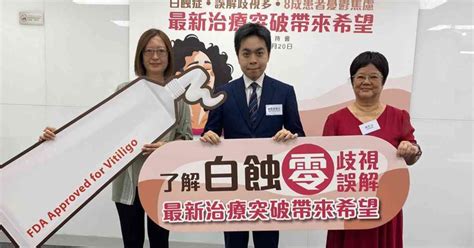 六旬婦臉部出白斑後蔓延至全身！醫生證患白蝕症︰香港逾4萬患者！公開主要成因、4大常用治療方法 健康解「迷」 醫學通識 健康好人生