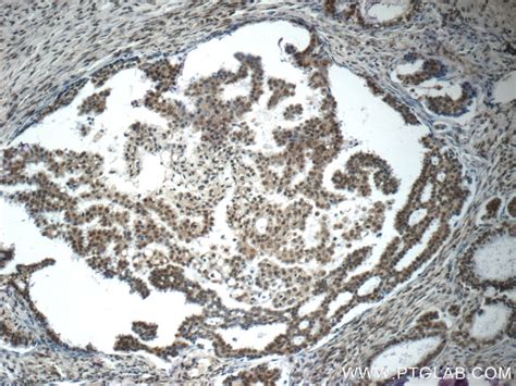 Ubiquitin Monoclonal Antibody United Bio Research