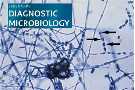 نمای میکروسکوپی گونه های کوکســیدیوئیدس Coccidioides Spp آزمایشگاه مجازی میکروب شناسی