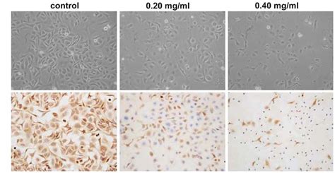 Morphological Changes Of SKOV3 Ovarian Cancer Cells In Response To
