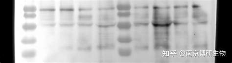 Wb实验抗体浓度过高的危害 知乎 Wb实验抗体浓度过高的危害 知乎