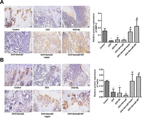 A Immunohistochemical Detection And Quantitative Analysis Of Bmp 2