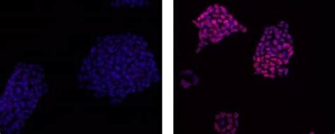 Sox2 Efluor 570 Clone Btjce Ebioscience™ 25μg Efluor 570 Sox2