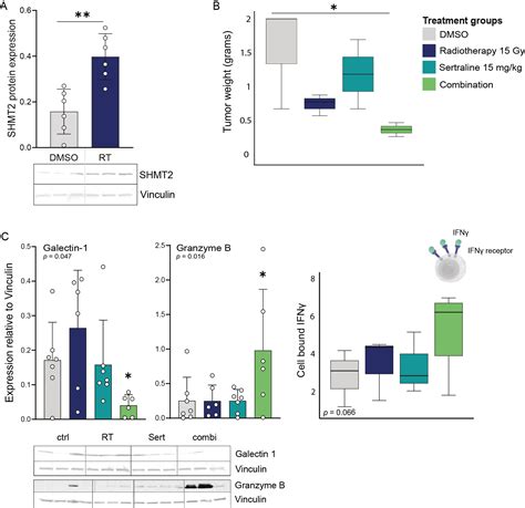 Targeting Serine Glycine Metabolism Improves Radiotherapy Response In
