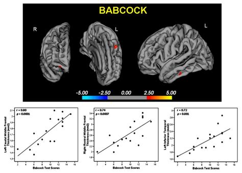 Regions With Significant Correlation Between Memory Performance