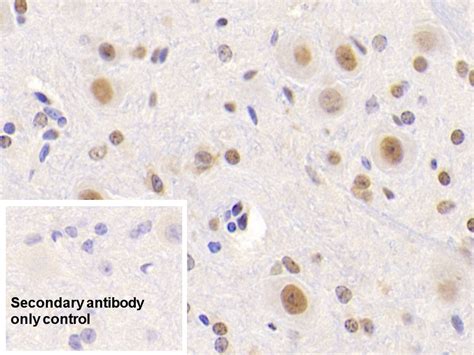 PAC242Mu01 核仁素 NCL 多克隆抗体 Mus musculus Mouse小鼠 USCN 武汉优尔生商贸有限公司