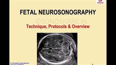 Fetal Neurosonography Technique Guidelines And Overview Youtube
