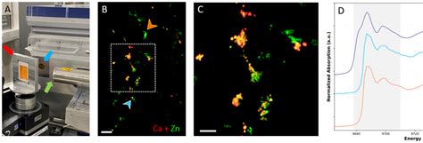 X Ray Spectroscopy Analyses On Paraffin Embedded Breast Resection Using