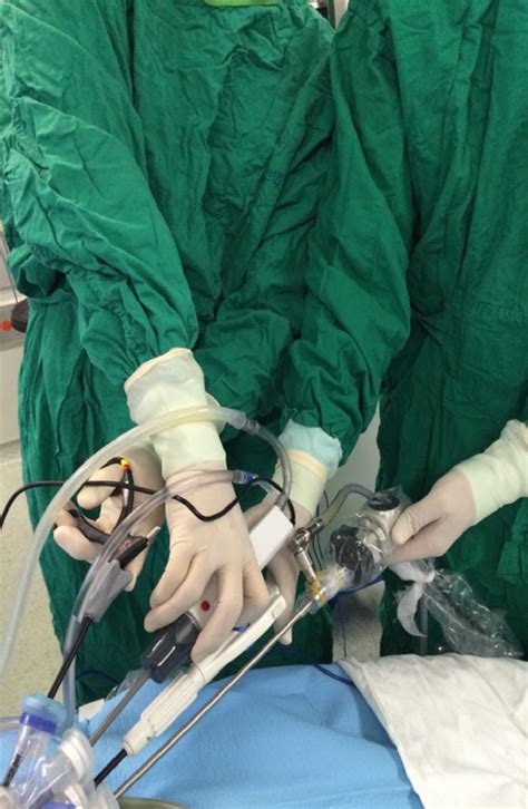 Position Of Single Site Laparoscopic Cholecystectomy Download Scientific Diagram