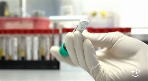 Psoriatic Arthritis Additional Tests Doctorpedia Doctor Reviewed Video
