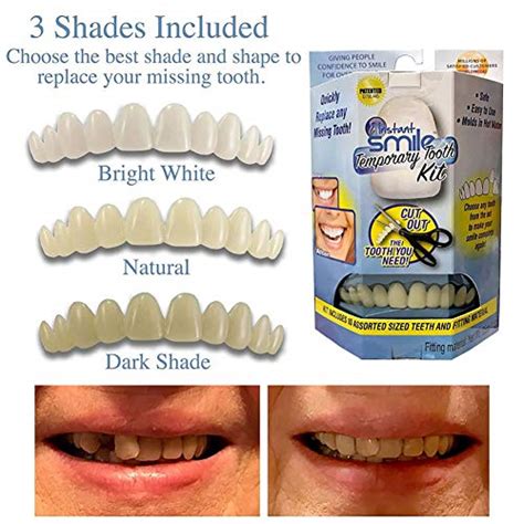Instant Smile Temporary Tooth Kit How To Fit An Easy Off