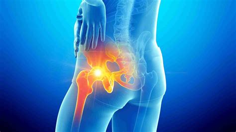 Facet Joint Injections Alton Pain Clinic