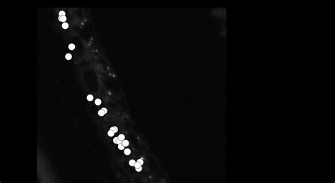 Export Of Point Annotations From Imaris Usage And Issues Imagesc Forum