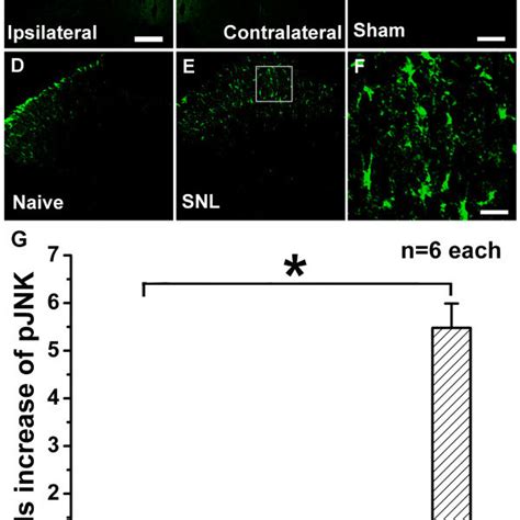 Cellular Localization Of Pjnk Expression In Spinal Dorsal Horn After
