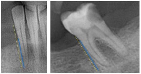 Analyzing Oral Health Conditions In Sex Workers—a Comparative