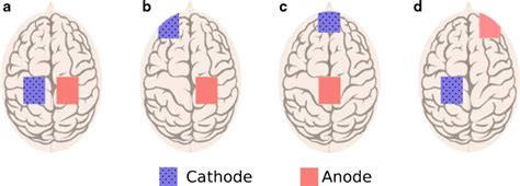Tdcs Montages A Bihemispheric B Unilateral Anodal Tdcs C Midline