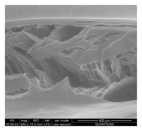Sa La1 Hydrogel Sphere Cross Section Download Scientific Diagram