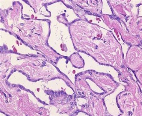 Histology Male Reproductive System Flashcards Quizlet