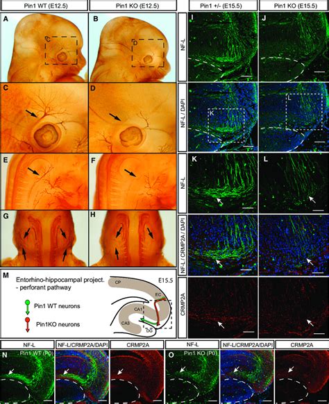 Pin1 Ko Leads To Developmental Axon Growth Defects In The Peripheral