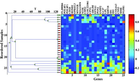 Expression Profiles Of Acute Lymphoblastic And Myeloblastic Leukemias