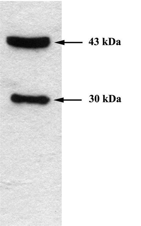 Anti Cebp Alphacebpa Antibody Ab15048 Abcam