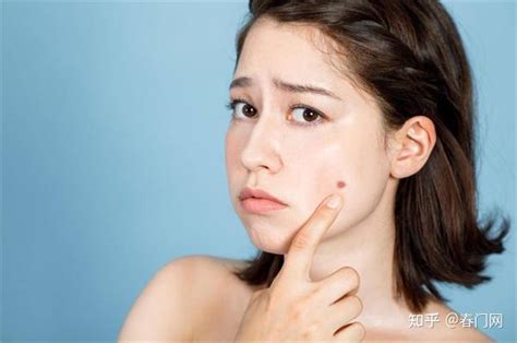 祛痘护肤品哪个牌子好？真实好用的祛痘护肤品推荐 知乎