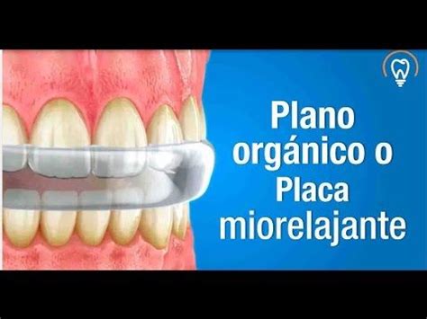 Plano Orgánico O Placa Miorrelajante Tu Salud Guía Placas Dentales
