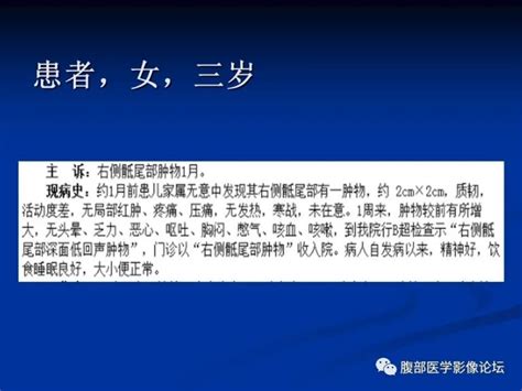 【ppt】盆腔卵黄囊瘤1例ct 影像ppt