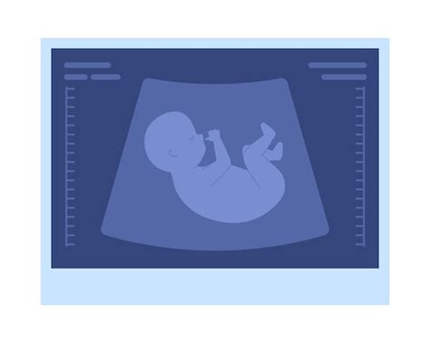 Premium Vector Fetal Ultrasound Picture Semi Flat Color Vector Object