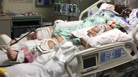 Mujer Sobrevive A Un Accidente De Tráfico Que Le Ocasionó Una