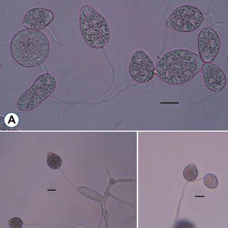 Proliferation Of Sporangia A B Internal Nested Proliferation C