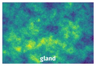 GlaS MICCAI 2015 Gland Segmentation Dataset Ninja