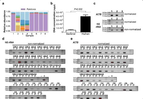 unintentional bacterial and human dna interference in molecular
