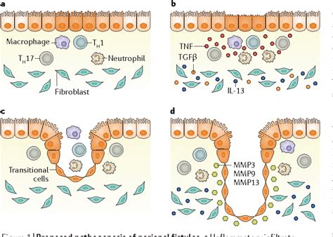 Figure 2 From Perianal Fistulizing Crohns Disease Pathogenesis