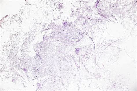 Motor Neuron Spinal Cord Nerve Fibres And Nerve Cells Under The Microscope Stock Image