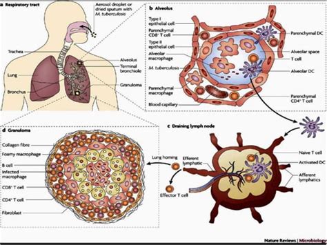 Introduction To Pediatric Tuberculosis