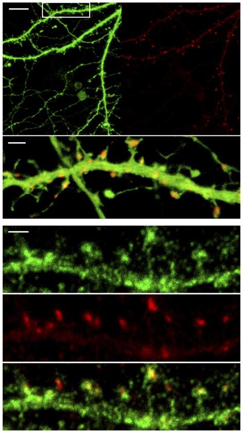 Confocal Overview Of Striatal Cultures Showing Dendritic Spine Download Scientific Diagram