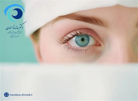 دکتر ماندانا احمدی فوق تخصص پیوند قرنیه، سگمان قدامی و لیزیک