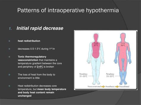 PPT Perioperative Hypothermia PowerPoint Presentation ID 2352565