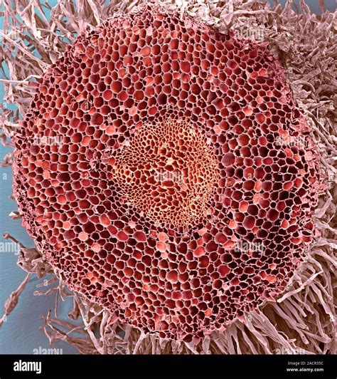 Dicotyledon Root Coloured Scanning Electron Micrograph Sem Of A