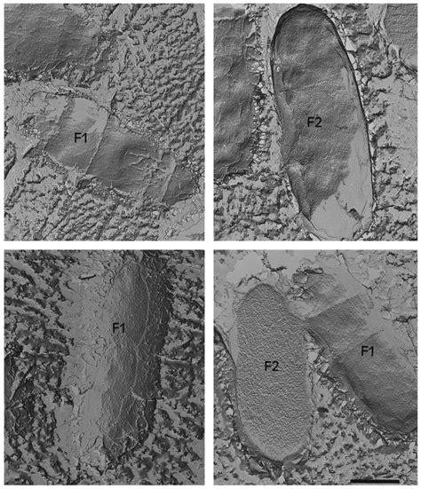 Electron Micrograph Of A Freeze Fracture And Deep Etched Preparation Of