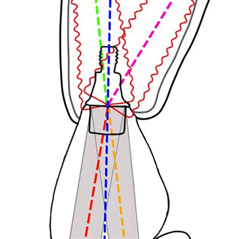 Measurements Related To The Angulation Of Abutment And The Angulation Download Scientific