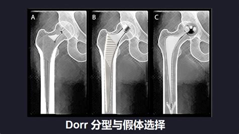文章详情