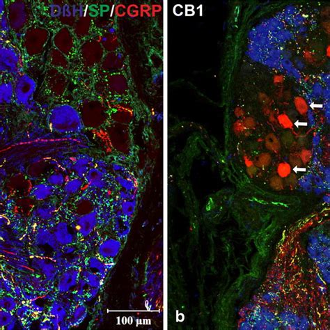 Percentages Of Dopamine β Hydroxylase Dβh A Vesicular Download Scientific Diagram