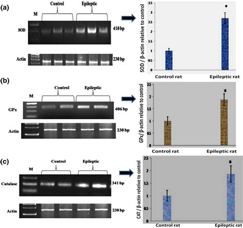 Rt Pcr Reverse Transcriptase Polymerase Chain Reaction Analysis Of A