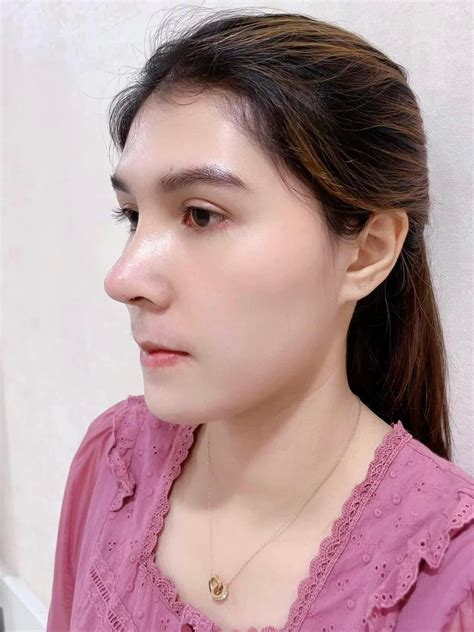 ทรงสโลปหมอวี หวานๆ หทัยทิพย์ คลินิก สาขาพระราม2