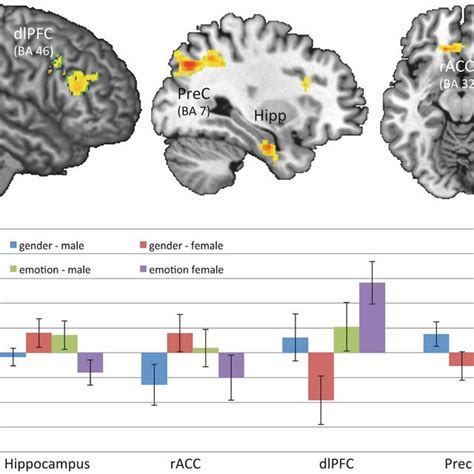 A Statistical Parametric Map And B Parameter Estimates Illustrating
